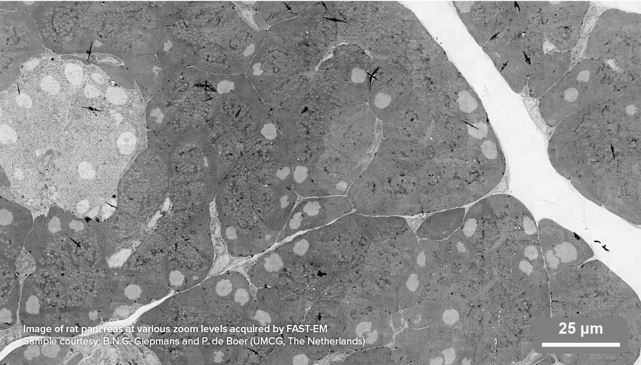 FAST-EM | Ultra-fast automated multibeam electron microscope